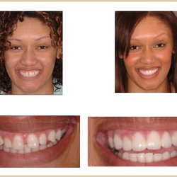 AL A FALLAH, DDS - 29 Photos & 28 Reviews - General Dentistry - 1293 ...