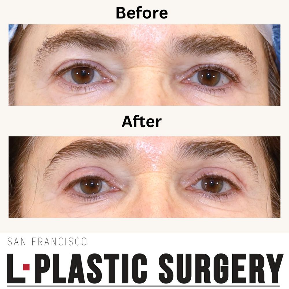 L PLASTIC SURGERY - CHARLES K LEE MD - Updated December 2025 - 245 ...