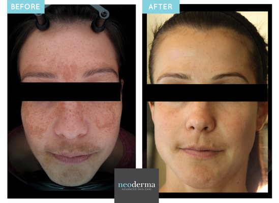 NEODERMA - Updated December 2025 - 478 Photos & 307 Reviews - 1175 E ...