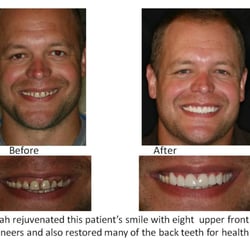 AL A FALLAH, DDS - 29 Photos & 25 Reviews - 1293 Carlsbad Village Dr ...