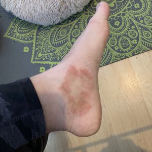 CALEB JEON, MD - Updated December 2025 - 19 Reviews - Berkeley ...