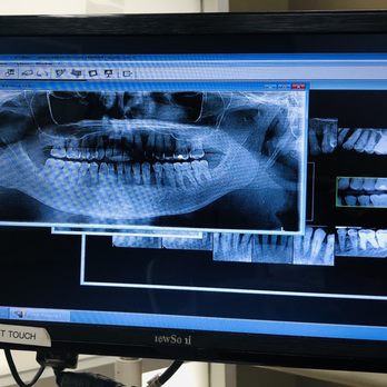 ASPEN DENTAL - Updated June 2025 - 18 Photos & 43 Reviews - 15450 ...