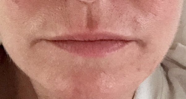 SPRING DERMATOLOGY - Updated January 2026 - 60 Reviews - 20311 ...