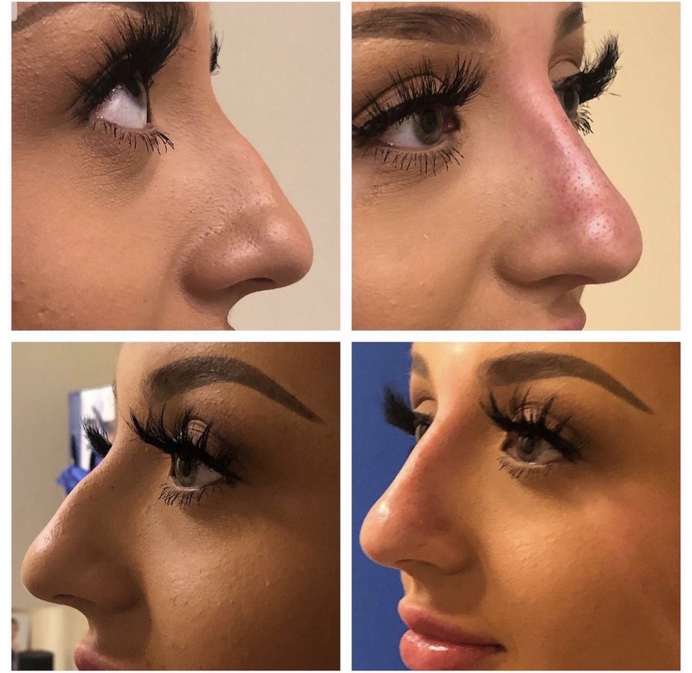 SKIN ADDICTION - 49 Photos & 11 Reviews - 16030 Bothell Everett Hwy ...