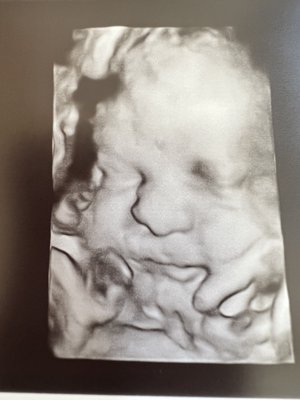 ATRIUM HEALTH - CABARRUS - Updated July 2025 - 57 Photos & 71 Reviews ...