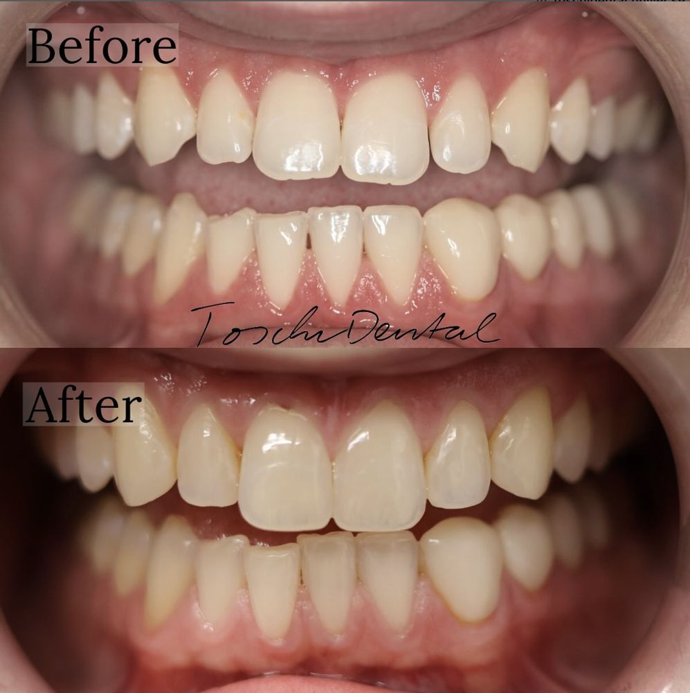 TOSCHI DENTAL: STEVEN M. TOSCHI, DDS AND JEFFERY TOSCHI, DMD - Updated ...