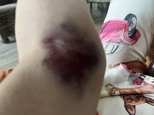 LABCORP - Updated August 2025 - 32 Photos & 89 Reviews - 960 E Green St ...