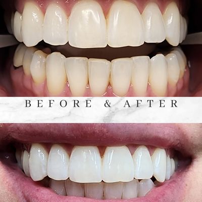 DIAMOND SMILES BY MELINDA - Updated April 2024 - Request an Appointment ...