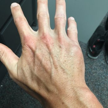 MELBOURNE HAND CENTER - Updated December 2025 - 13 Reviews - 2010 W Eau ...