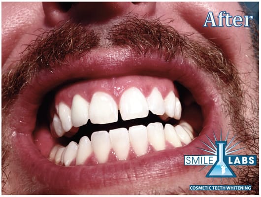 SMILE LABS - WEST HOLLYWOOD - Updated October 2025 - 75 Photos & 14 ...