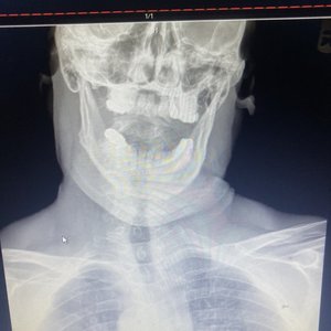 METHODIST MINOR MEDICAL CENTER - Updated June 2025 - 25 Reviews - 1803 ...