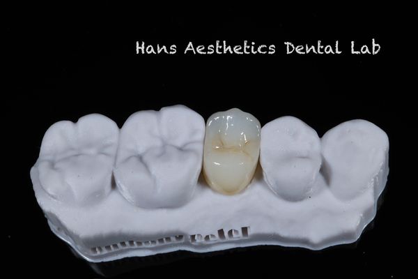 HANS AESTHETICS DENTAL LAB - Updated August 2025 - 40 Photos - 131 West ...