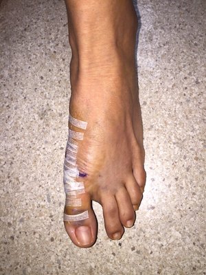 PARKSON LIN, D.P.M., FOOT & ANKLE SURGEON - Updated October 2025 - 17 ...