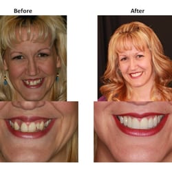 AL A FALLAH, DDS - 29 Photos & 28 Reviews - General Dentistry - 1293 ...