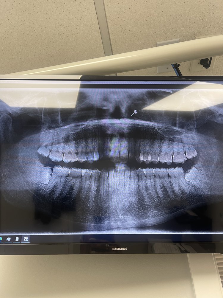 TORIN RUTNER, DDS - Updated December 2025 - 10 Reviews - 552 Westfield ...