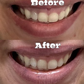 LEXINGTON ENDODONTICS - Updated January 2026 - 620 Perimeter Dr ...