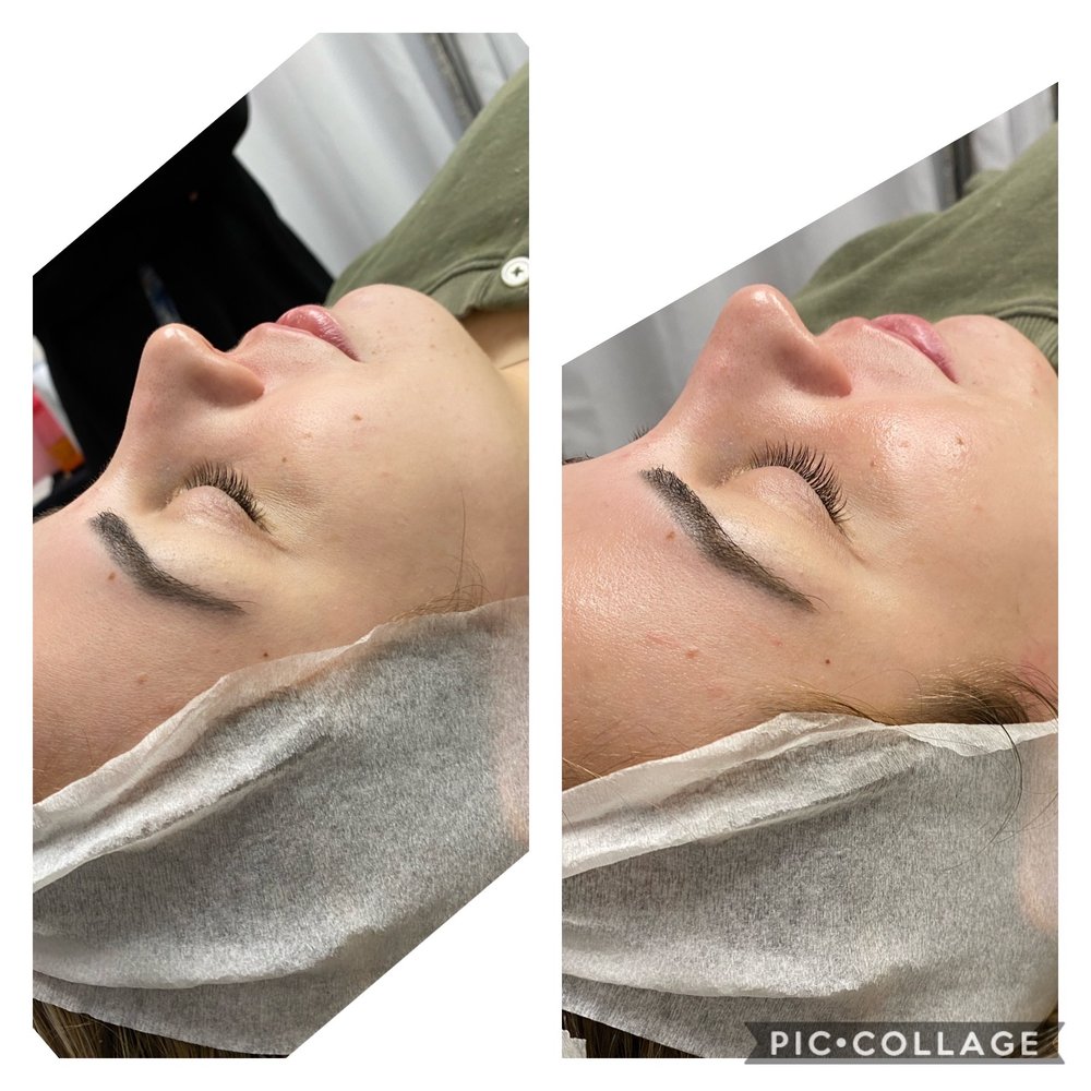 RAE AESTHETIC’S - Updated November 2025 - 19 Photos - 201 East Erie St ...