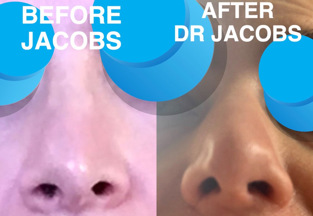 THE JACOBS CENTER FOR COSMETIC SURGERY - 65 Photos & 33 Reviews - 145 ...