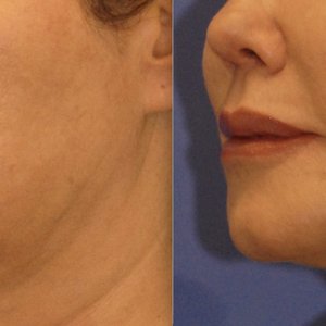 CAMELBACK DERMATOLOGY & SKIN SURGERY - Updated April 2025 - 14 Photos ...