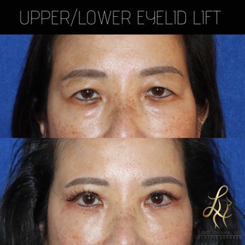 LISA HWANG, MD - Updated January 2026 - 282 Photos & 41 Reviews - 3803 ...