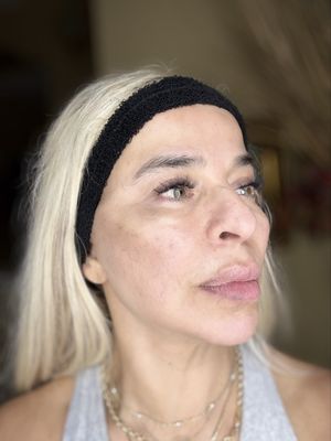 JASON EMER, MD - Updated December 2025 - 1166 Photos & 520 Reviews ...