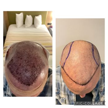 ADVANCED HAIR RESTORATION - Updated December 2025 - 96 Photos & 48 ...