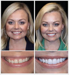 SMILE TEXAS - Updated December 2025 - 21 Photos & 15 Reviews - 4665 ...