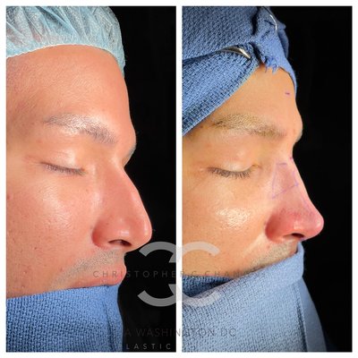CONGRESSIONAL PLASTIC SURGERY | CHRISTOPHER C. CHANG, M.D - Updated ...