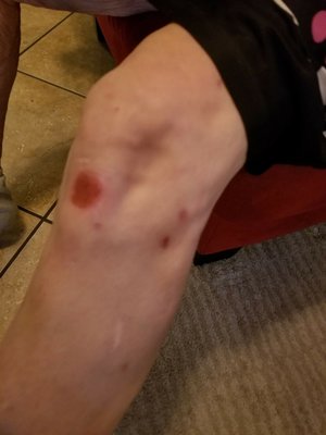 RECOVERY INNOVATIONS - Updated April 2024 - 14 Photos & 34 Reviews ...