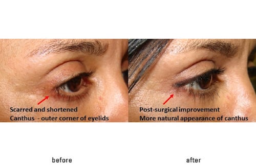 GUY MASSRY, MD - Updated December 2025 - 154 Photos & 176 Reviews - 150 ...