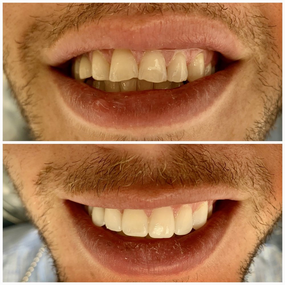 MIRACLE SMILE DENTISTRY - Updated May 2024 - 116 Photos & 41 Reviews ...