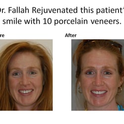 AL A FALLAH, DDS - 29 Photos & 28 Reviews - General Dentistry - 1293 ...