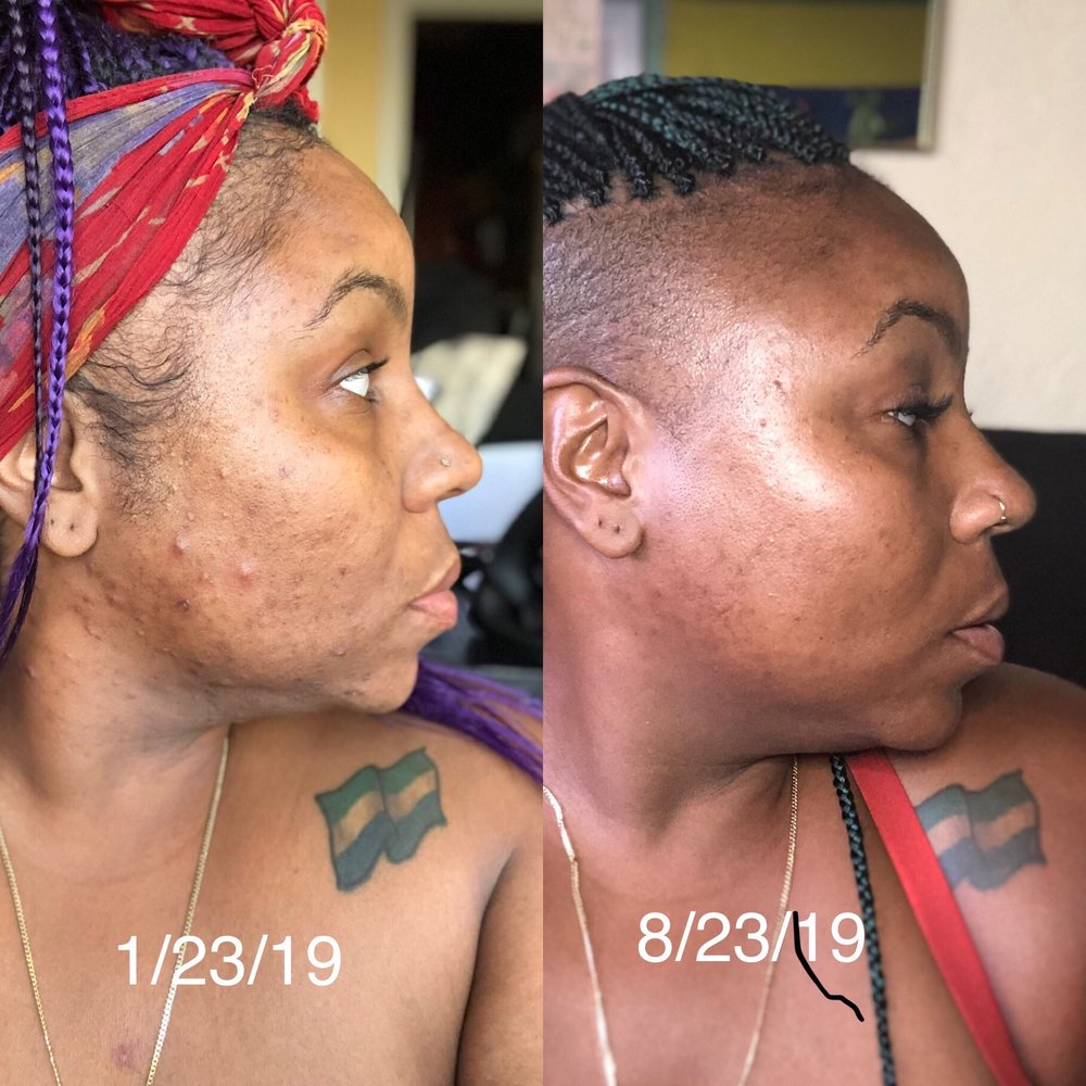 THE SKIN STUDIO - 35 Photos & 49 Reviews - 4125 Piedmont Ave, Oakland ...