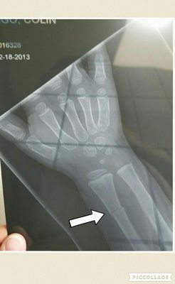 VALLEY RADIOLOGY - EAST SAN JOSE - Updated October 2024 - 30 Photos ...