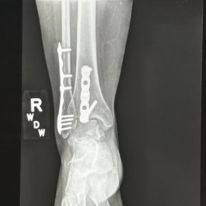 THE HEART HOSPITAL BAYLOR DENTON - Updated September 2025 - 14 Reviews ...