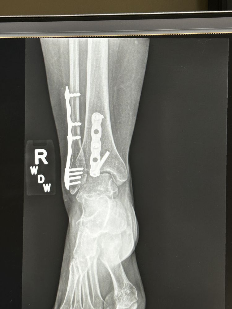 MEDICAL CITY DENTON CENTER FOR NEUROSCIENCE - Updated January 2026 - 15 ...