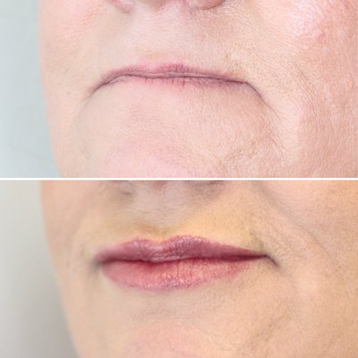 ELEVATE SMILE DESIGN - Updated May 2026 - 75 Photos & 15 Reviews ...