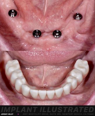 JEREMY HELDT, DDS - Updated March 2025 - 222 Photos & 105 Reviews ...