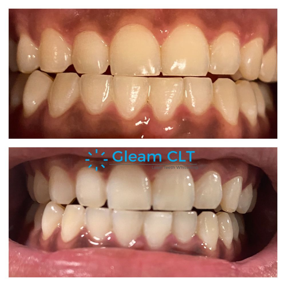 GLEAM CLT - Updated July 2025 - 316 E Blvd, Charlotte, North Carolina ...