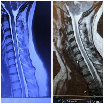 LIMESTONE OPEN MRI AND IMAGING CENTER - Updated October 2025 - 12 ...