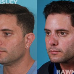 JEFFREY RAWNSLEY, MD - RAWNSLEY PLASTIC SURGERY - 61 Photos & 76 ...