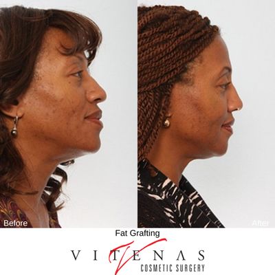 VITENAS COSMETIC SURGERY with photos - Updated August 2024 - 177 Photos ...