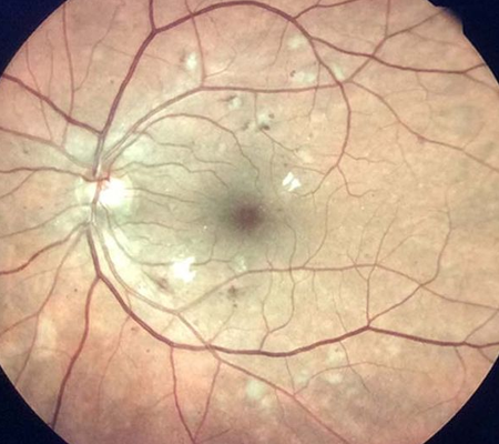 GRIN EYE CARE - Updated December 2025 - 14 Photos & 43 Reviews - 21020 ...