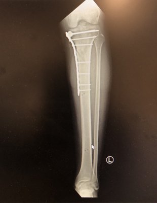 Premier Orthopaedic Trauma Specialists Updated February 2026 17