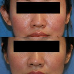 EVAN RANSOM, MD - 123 Photos & 171 Reviews - Cosmetic Surgeons - 450 ...