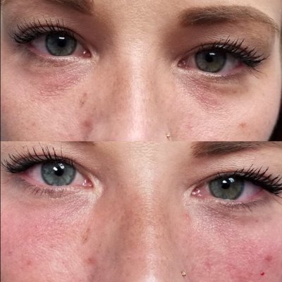 MIDSTATE SKIN INSTITUTE- JASMINE - Updated March 2025 - 30 Photos ...