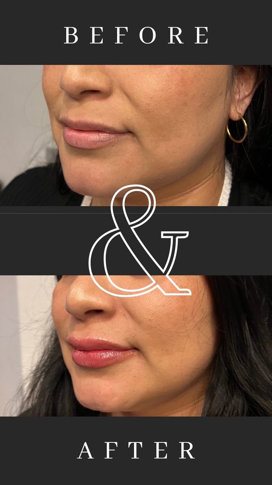 DRIPS AND LIPS AESTHETICS - Request an Appointment - 4320 Atlantic Ave ...