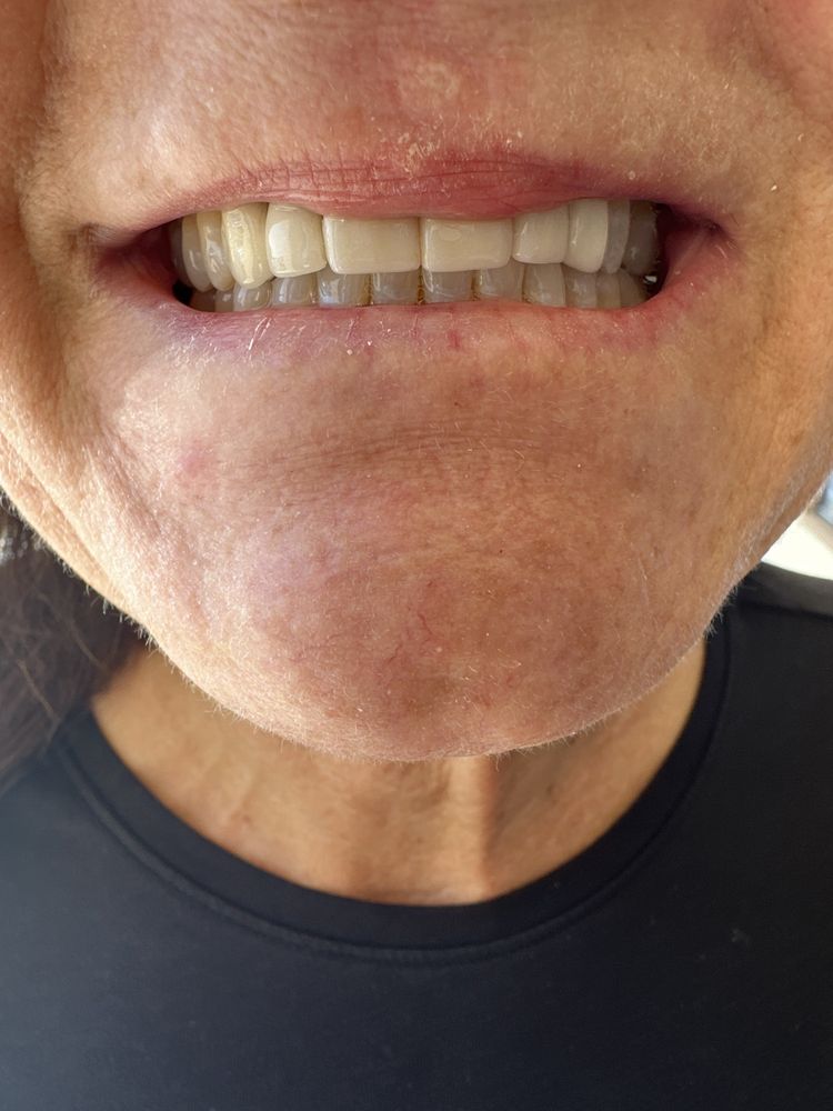 BLASH DENTISTRY - Updated December 2025 - 70 Reviews - 2791 Green River ...