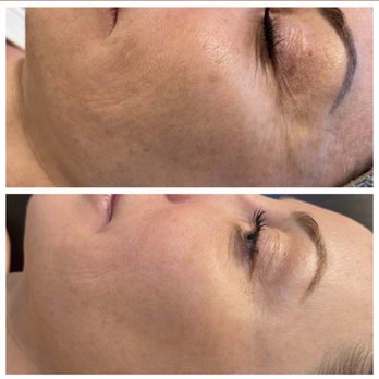 DIVINE AESTHETICS MED SPA - Updated December 2025 - 26 Photos & 20 ...