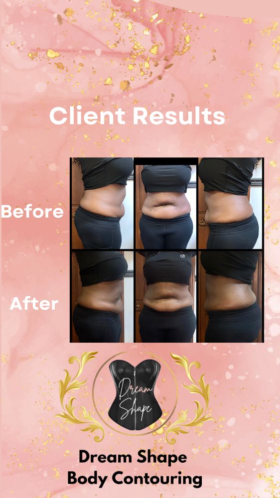 DREAM SHAPE BODY CONTOURING - Updated July 2025 - 24 Photos - 5750 ...